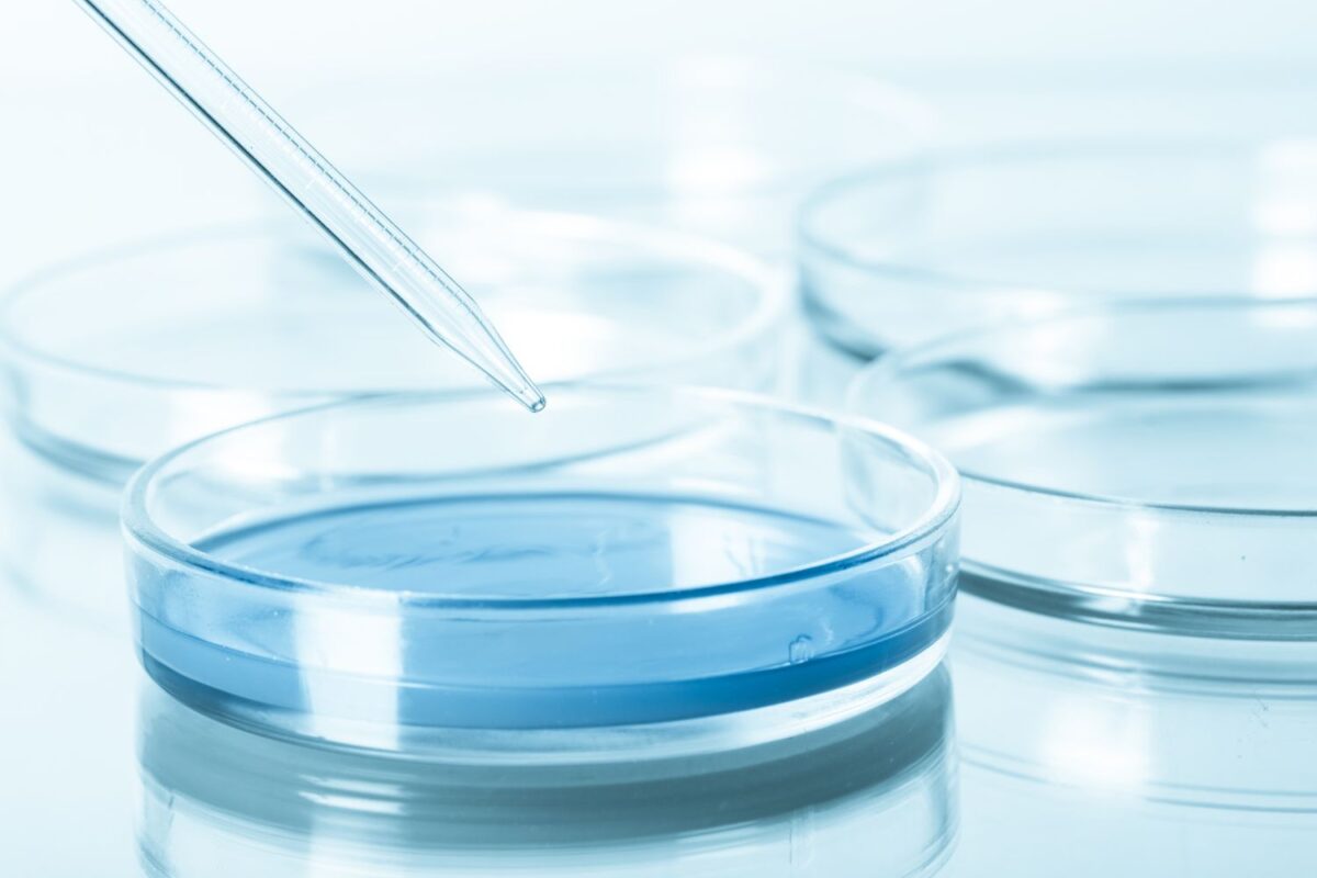 UMF vs MGO Ratings for Manuka Honey [Calculator] | Australia's Manuka